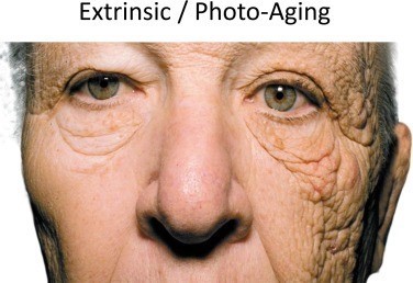 Healthy Aging Skin