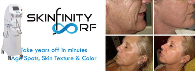 Collagen Stimulation Treatments