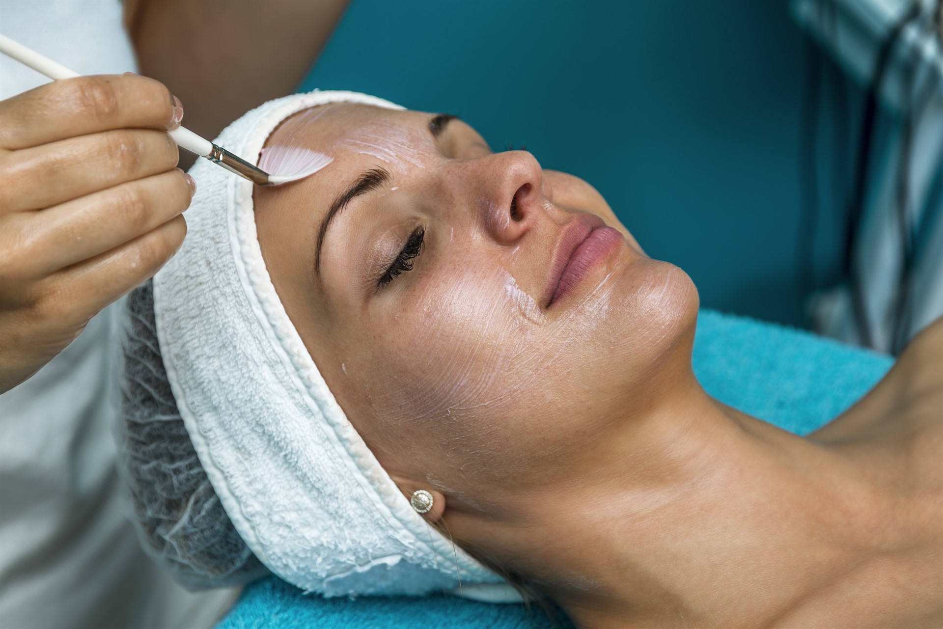 Appealing Results Start With A Chemical Peel Appealing Results Start With A Chemical Peel
